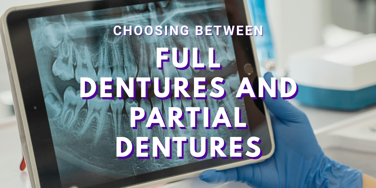 Full vs Partial Dentures: Which Is Right? | Logan City Denture