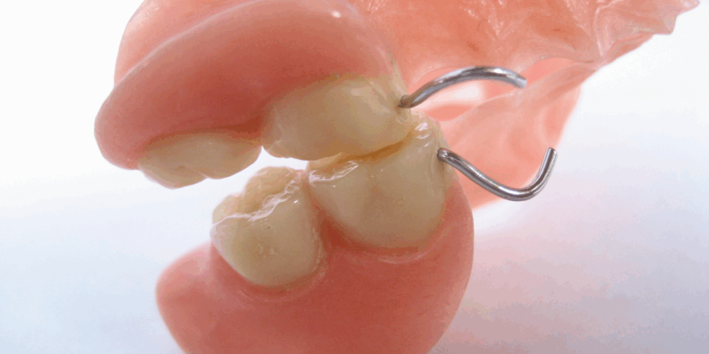 Full vs Partial Dentures: Which Is Right? | Logan City Denture